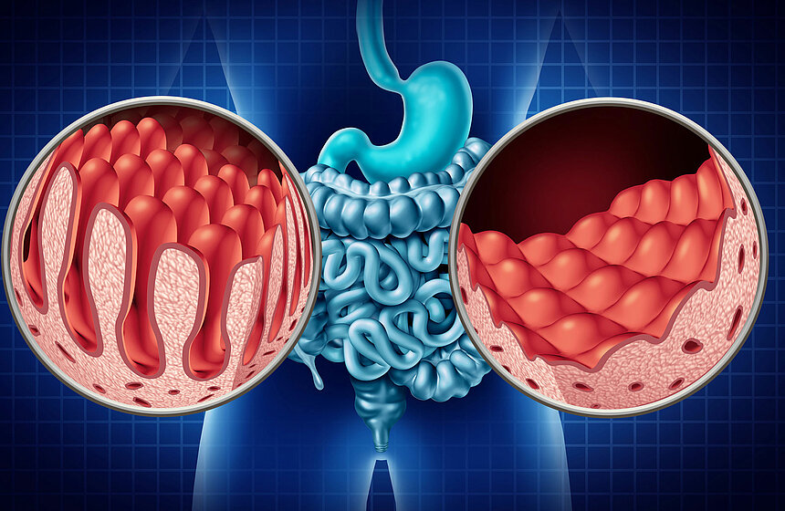 Magen-Darm-Diagnostik